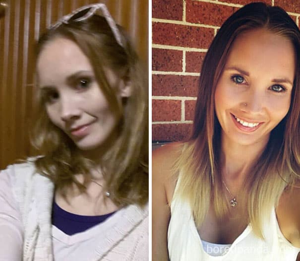 These 20+ Before & After Photos Reveal The Effects Of Giving Up Drugs ...