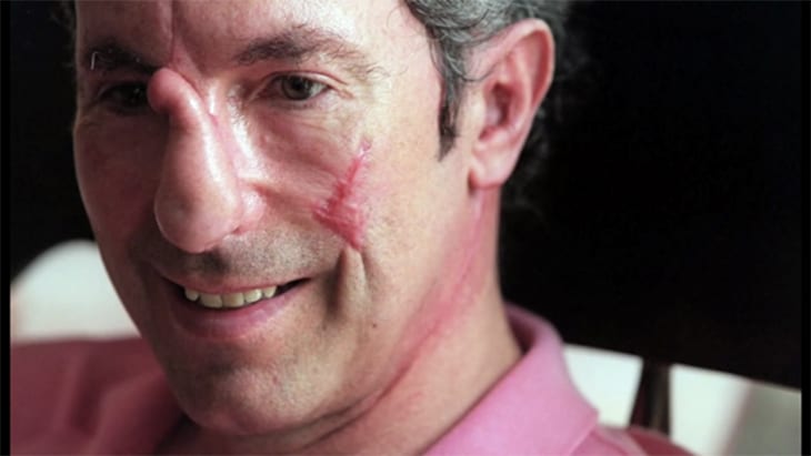 He Was Trapped On Mount Everest Alone For Hours In Below Freezing ...