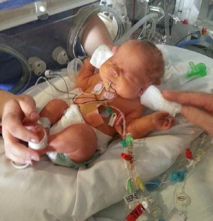 He Was Born Without A Lower Spine, But He Didn’t Let That Stop Him From ...